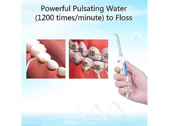 H2ofloss Dental Water Flosser